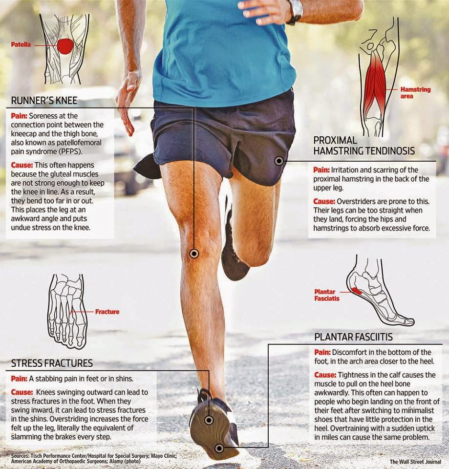 Accretive Health: Running-related injuries